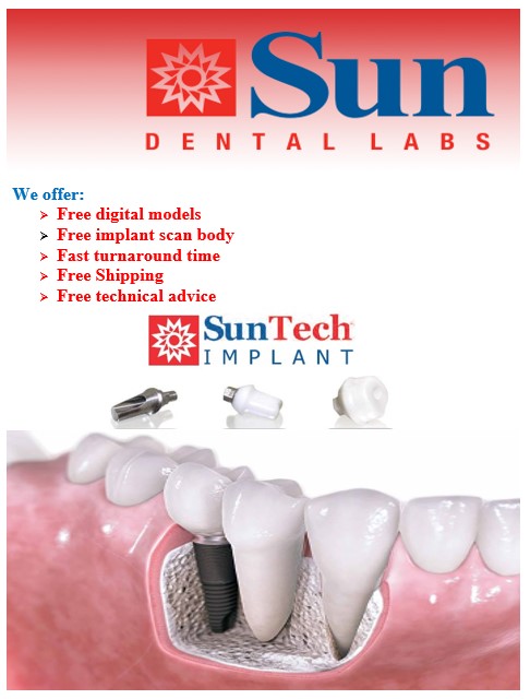 Sun Dental Labs | Digital Dental Lab | Dental Laboratory